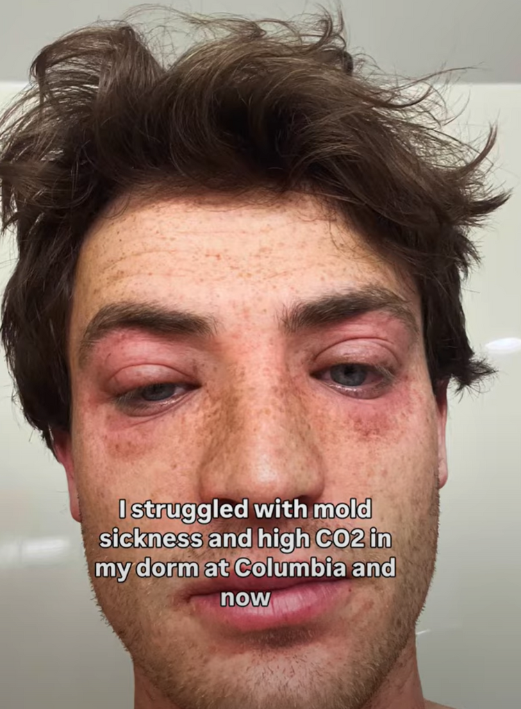 SWERV Window ERV | Fresh Air Year Round – SWERVAIR